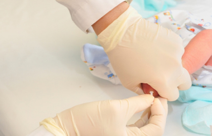 Quest - Article - Newborn Screening Recommended for Pompe Disease ... Quest - Article - Newborn Screening Recommended for Pompe Disease ...